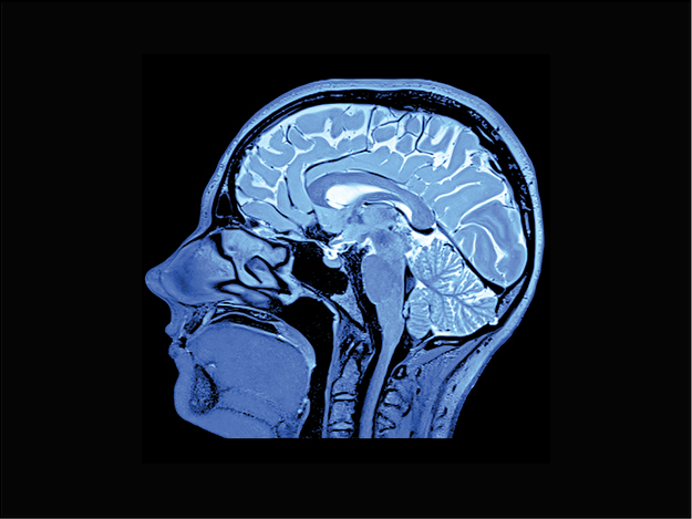 MRI | Hudson Valley Radiologists, P.C.